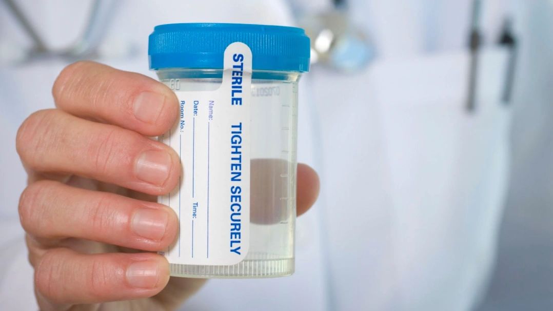 Toxicology testing and why its important