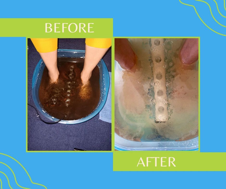 The Benefits of an Ionic Foot Bath: A Refreshing Detox Method