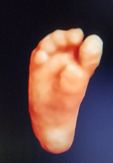 Memories in 4D - 3D / 4D / HD Ultrasound - Medina, Ohio