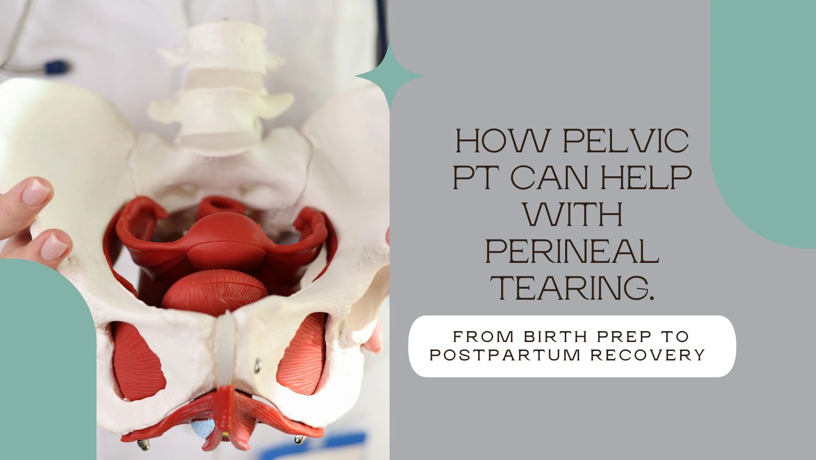 How Pelvic PT Can Help Perineal Tears