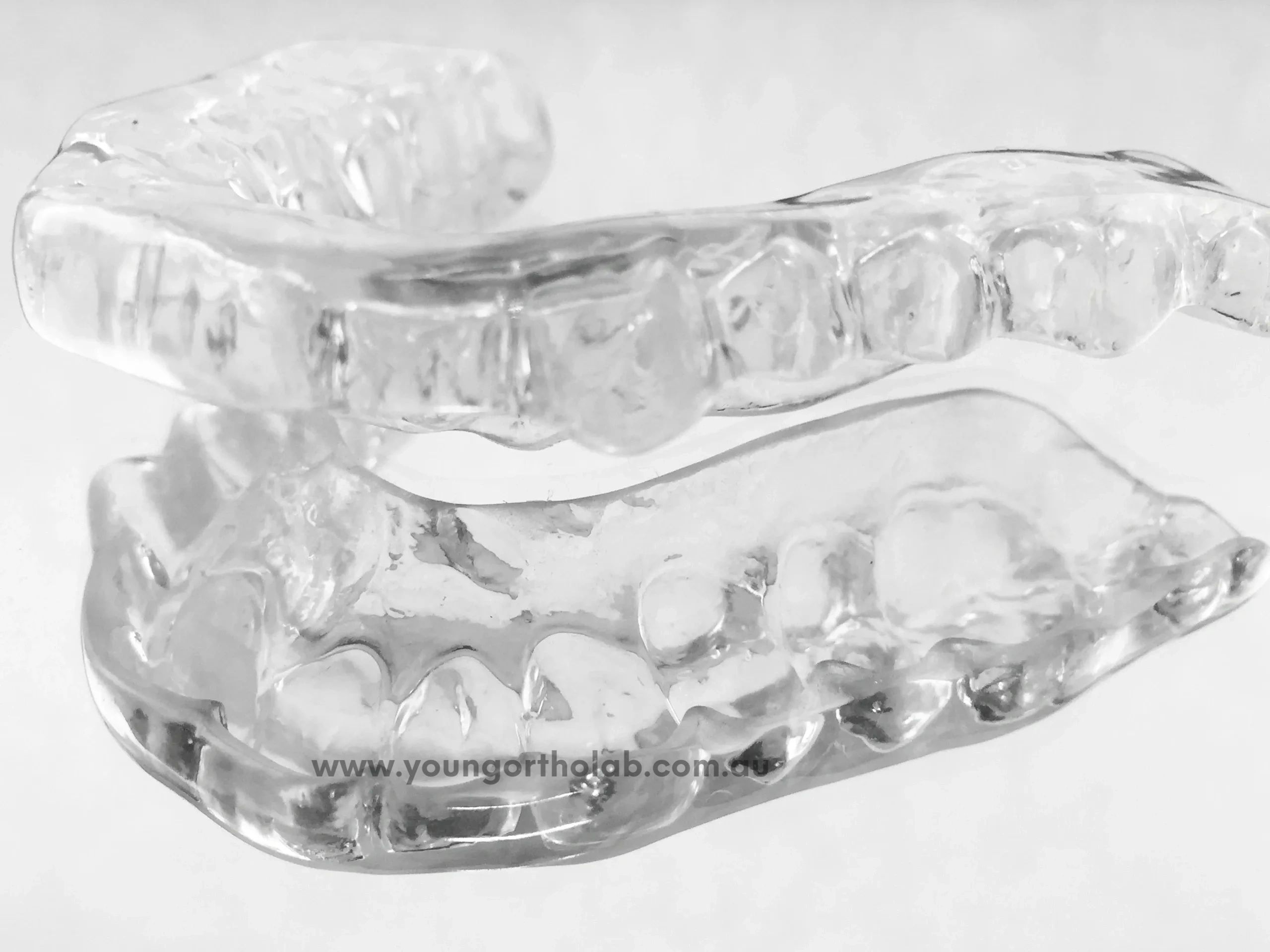 Orthodontic Laboratory - YOUNG ORTHODONTIC LABORATORY