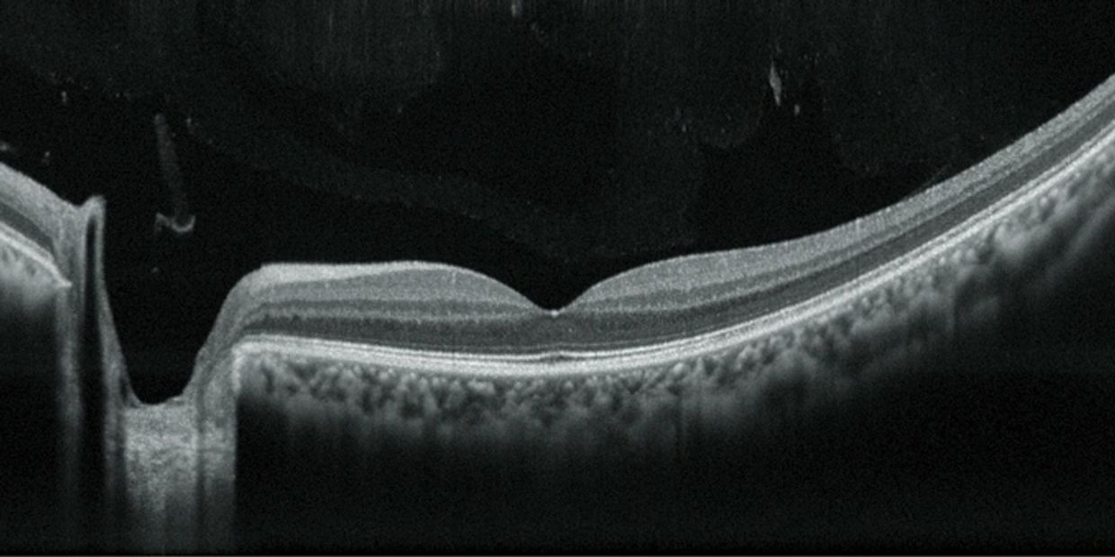 Bay Optometry - Retinal Imaging, Eye Health, Optometrist