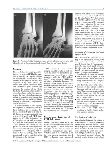 Fibula | DISLOCATION.COM.AU