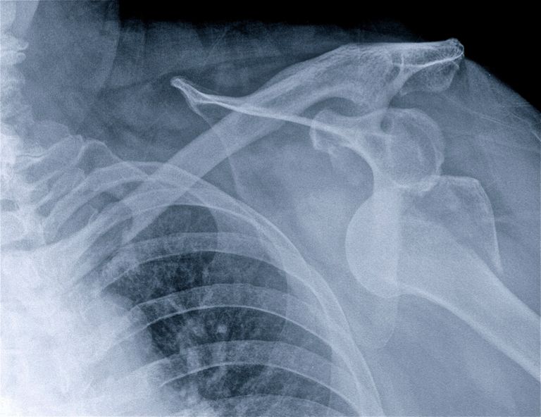 Dislocation - DISLOCATION.COM.AU