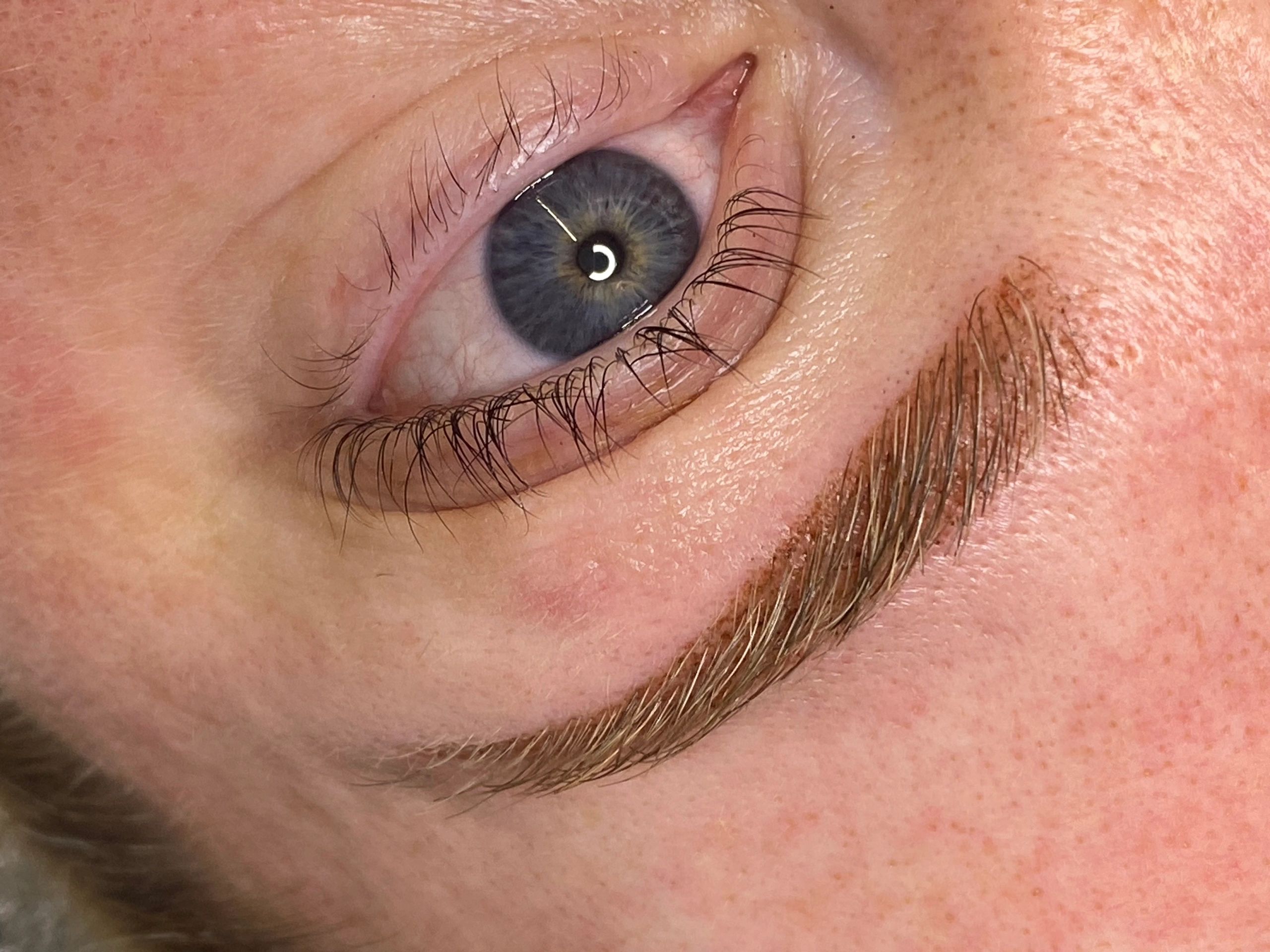 Enhance Your Look with Scalp Micropigmentation