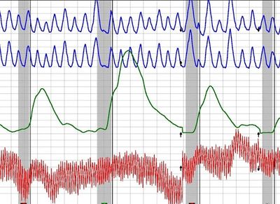Inland Polygraph - Polygraph, Lie Detector Test, Lie Detector