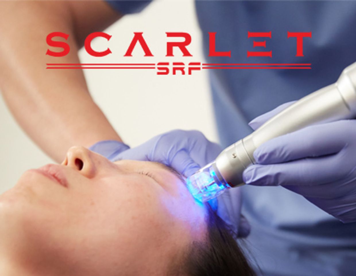 Scarlet RF Microneedling | Beauty by Bo
