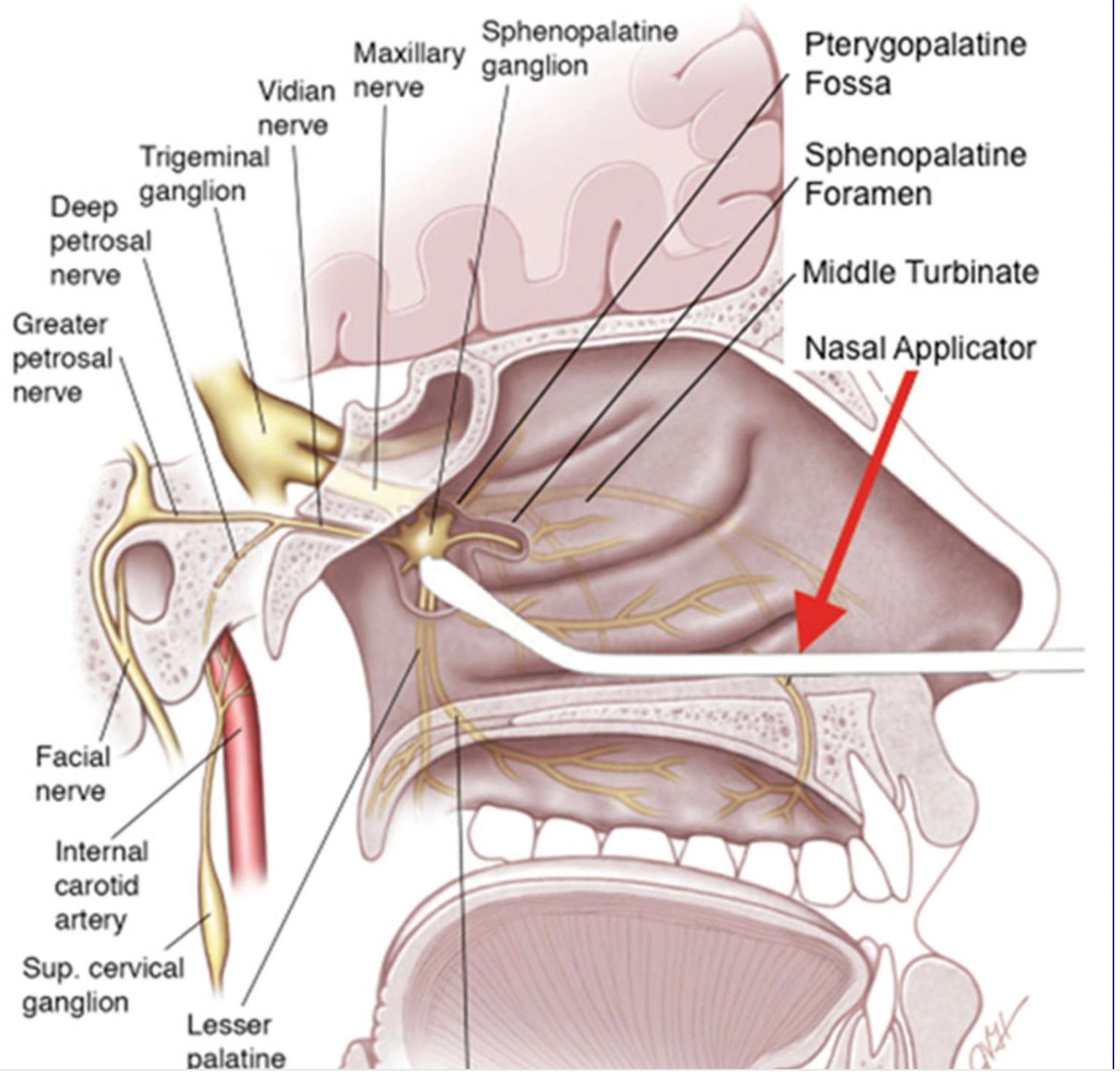 Sphenopalatine Foramen