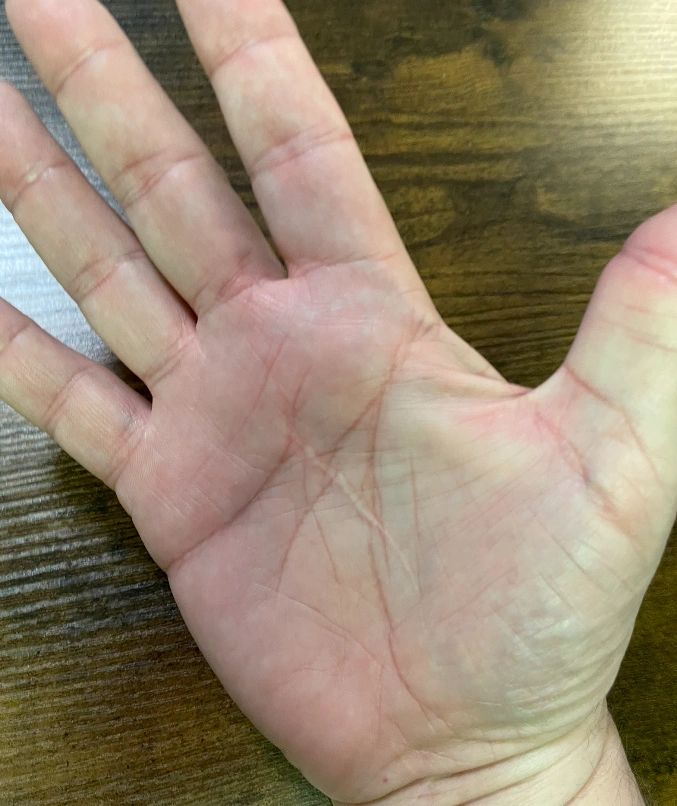 Scars, Symbols, and Sacred Principles