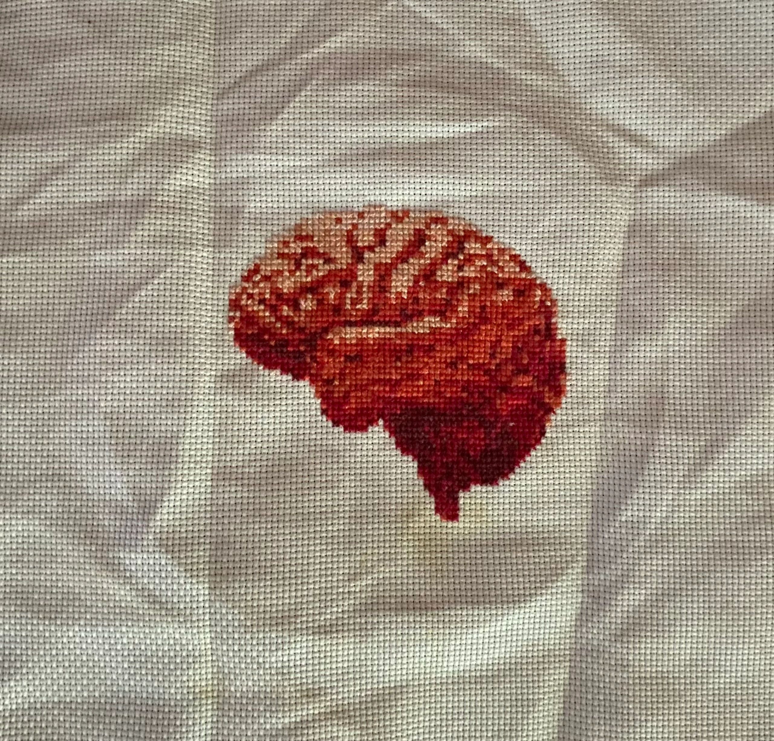 The Gut Brain Axis and psychiatric disorders.