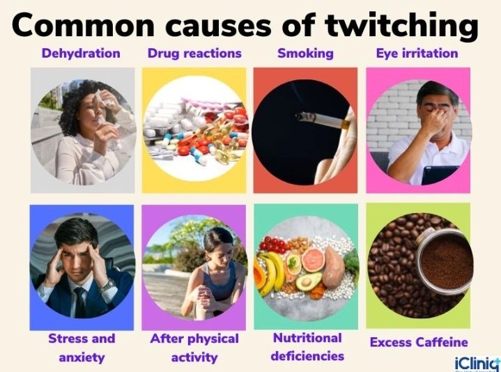 What Causes Muscle Twitches (Fasciculations)?