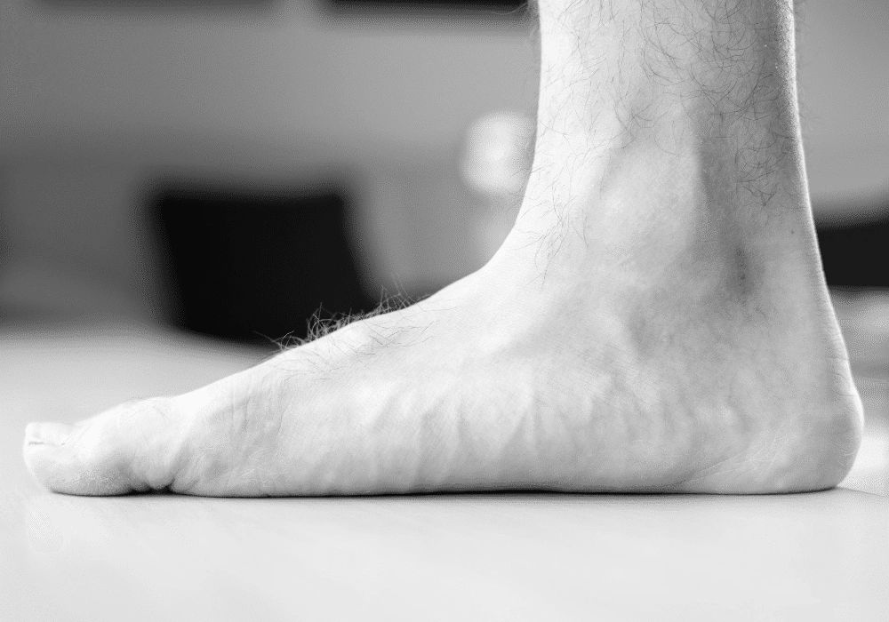 What Are The Implications Of Flat Feet?