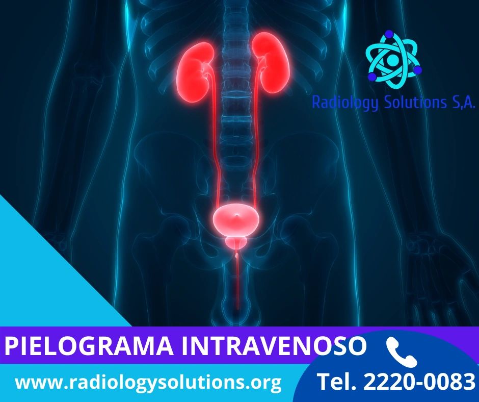 Qué es el Pielograma Intravenoso?