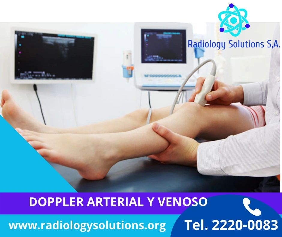 Utilidad del Doppler Venoso. Várices? Trombosis Venosa Profunda.