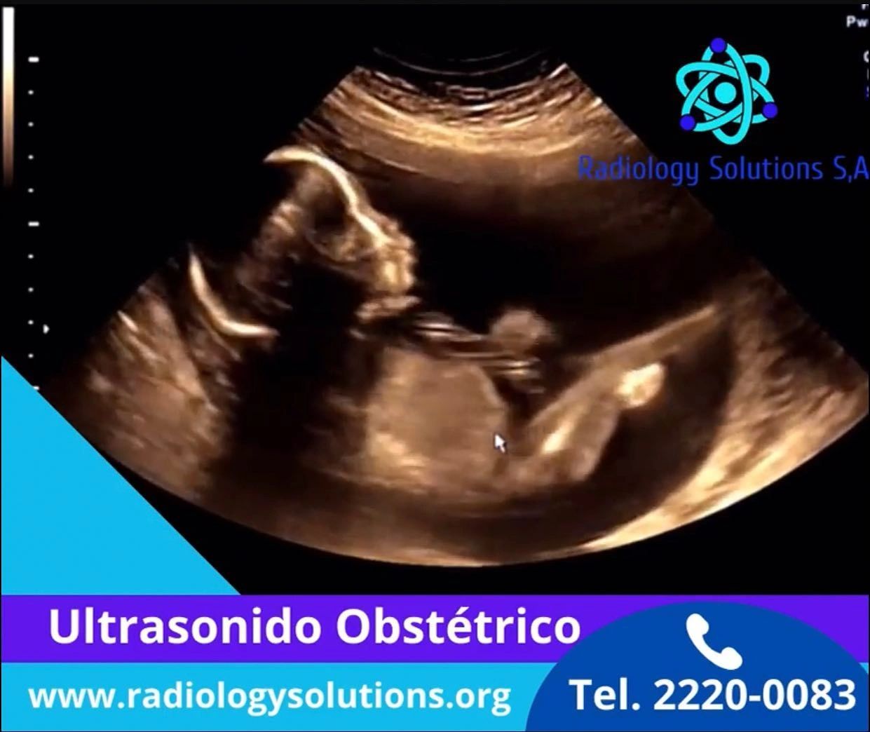 Ven a Conocer a tu Bebé!!. Ultrasonido Obstétrico