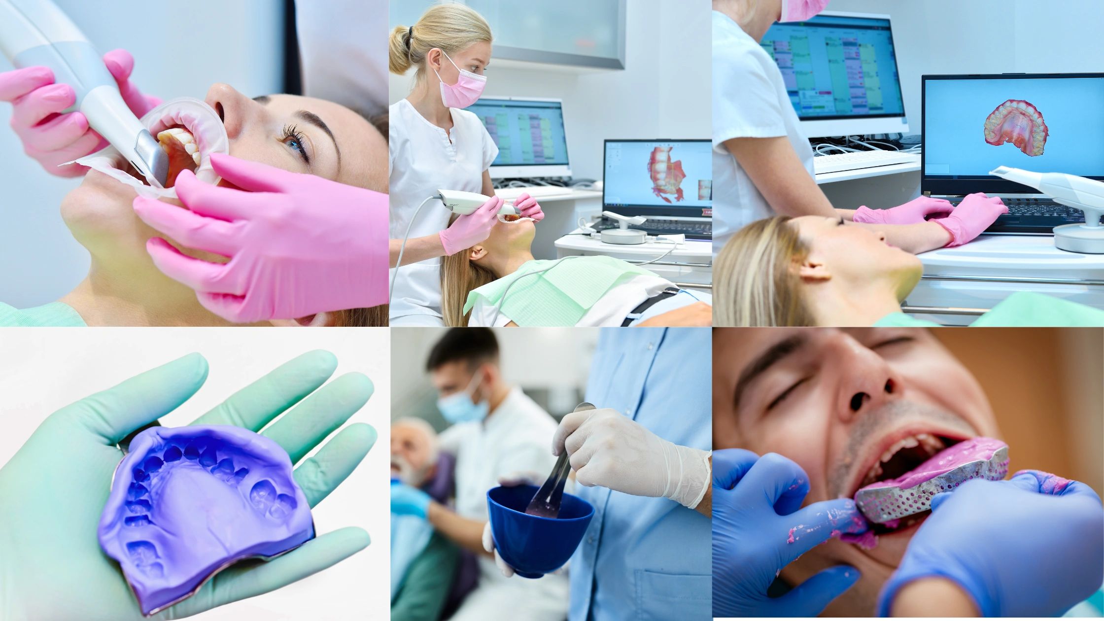 Digital Impressions vs. Conventional Dental Impressions