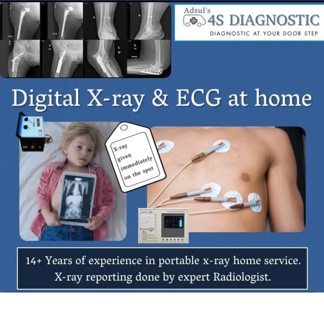 4S DIAGNOSTIC : Portable X-ray At Home Specialist & Diagnostic Centre