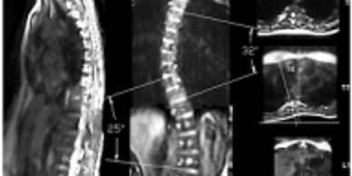Pinnacle Upright MRI | Pinnacle Open & Upright MRI