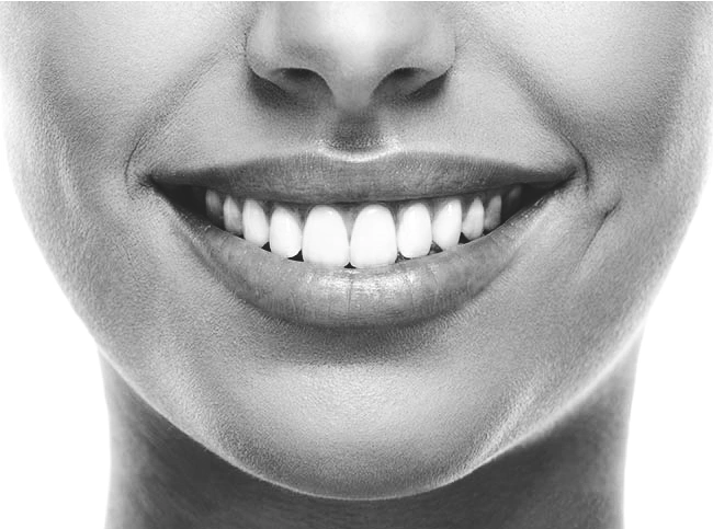 Professional Teeth Whitening in Gilbert - Sudden Gleam | Sudden Gleam