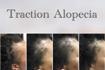 Hairagaininweeks.com