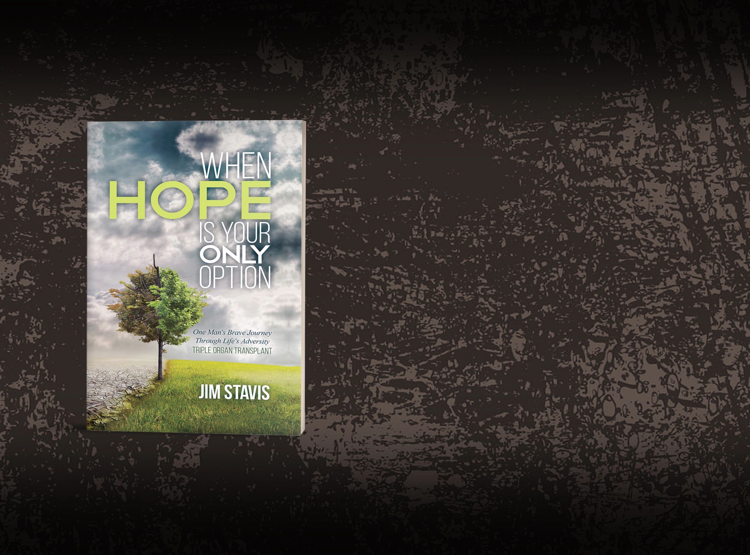 When Hope Is Your Only Option - Book, Organ Transplant, Amazon Books