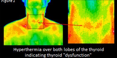 Thermography | Thermal Imaging Of Morton