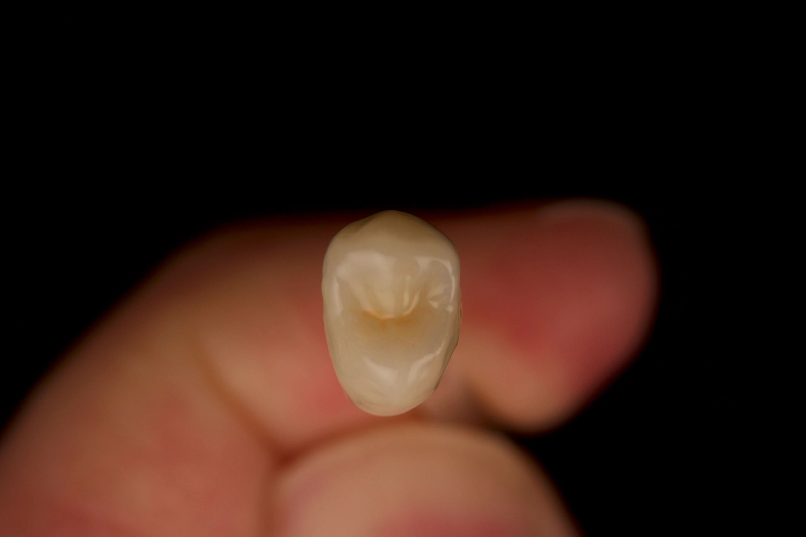 Victory Dental Lab - Posterior Crowns, Fast, Accurate, Economical