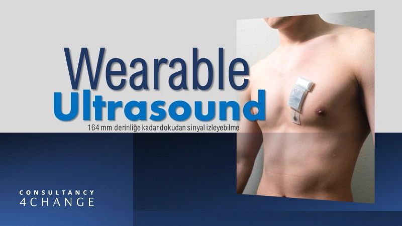 Fully Integrated Wearable Ultrasound
