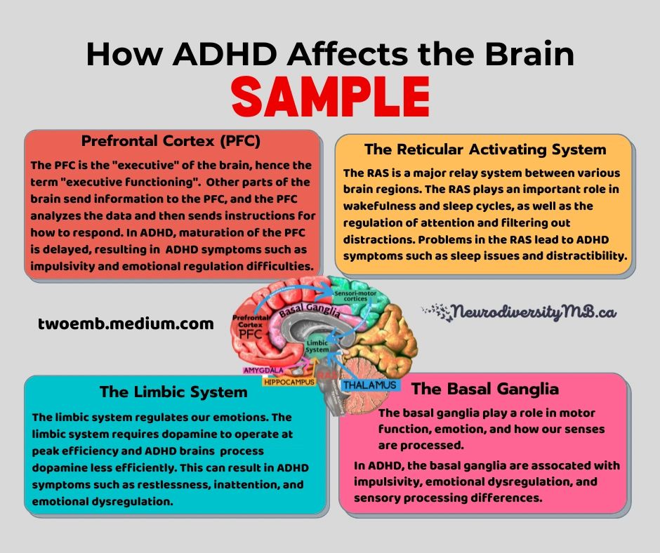 How ADHD Impacts the Brain Full Package