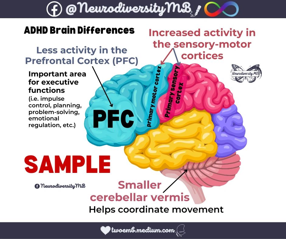 ADHD Brain Differences