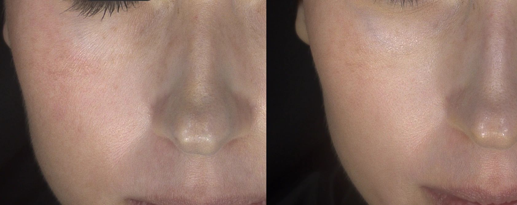 The Magic of CuRAS Hybrid: the Ultimate Q-Switched Nd:YAG Laser