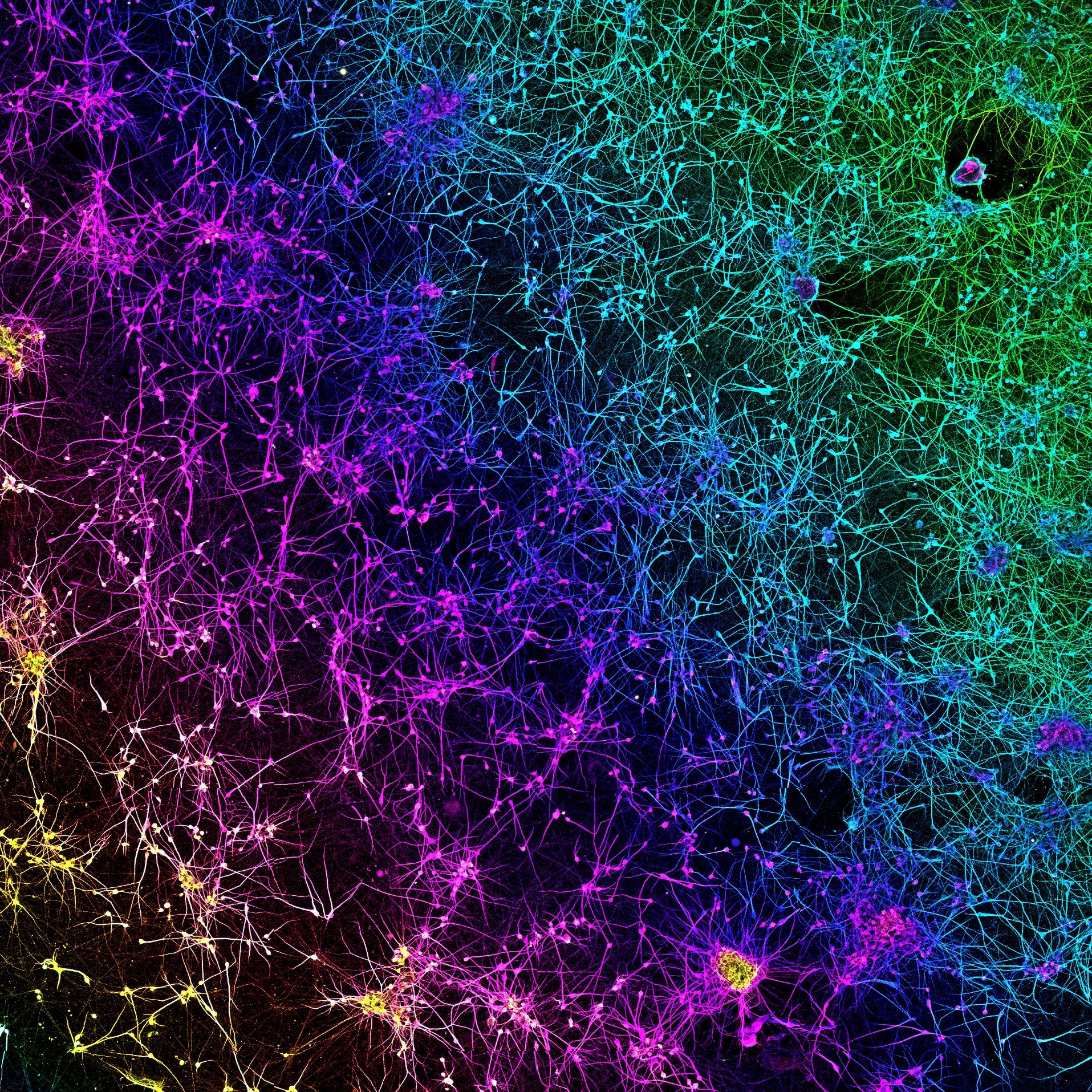Zeiss LSM980 Airyscan 2