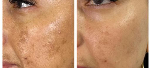 Royal Aesthetics & Injectables - Botox, Skin Care