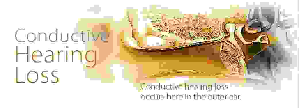 Conductive Hearing Loss | Bone Conduction Hearing Solutions