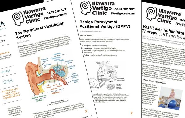 Vestibular Information - Illawarra Vertigo Clinic