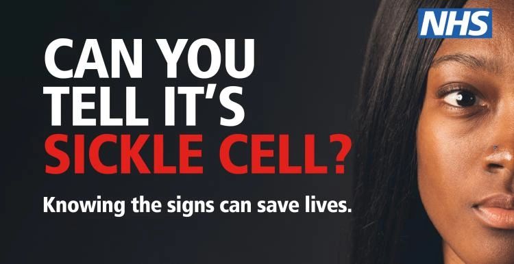 Collaboration with NHS Sickle Cell Quality Improvement Programme