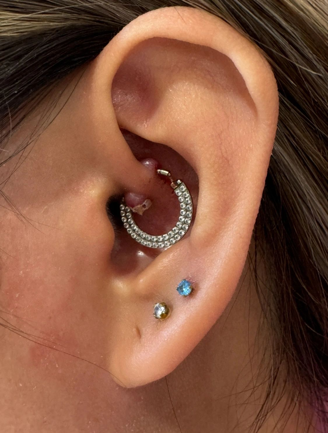 Summer & Problem Piercings: Why Bumps Happen & What Really Helps