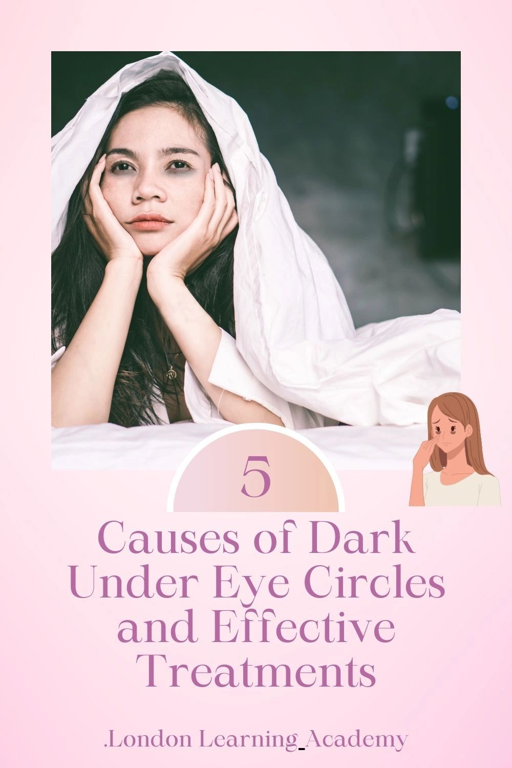 5 Causes of Dark Under Eye Circles