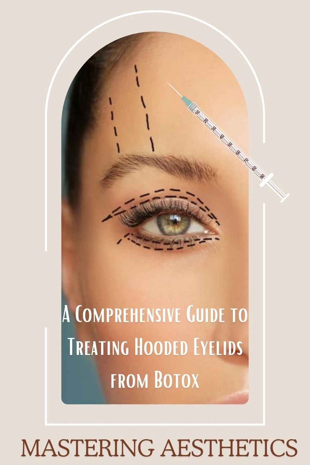 A Comprehensive Guide to Treating Hooded Eyelids from Botox
