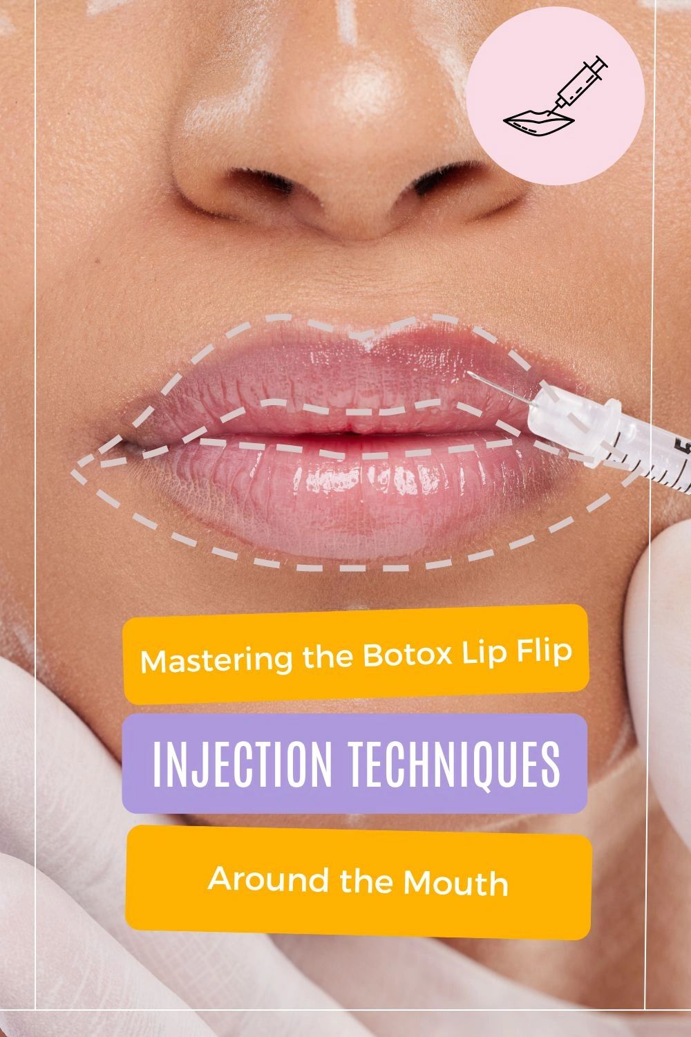Mastering the Botox Lip Flip: Injection Techniques For Mouth!