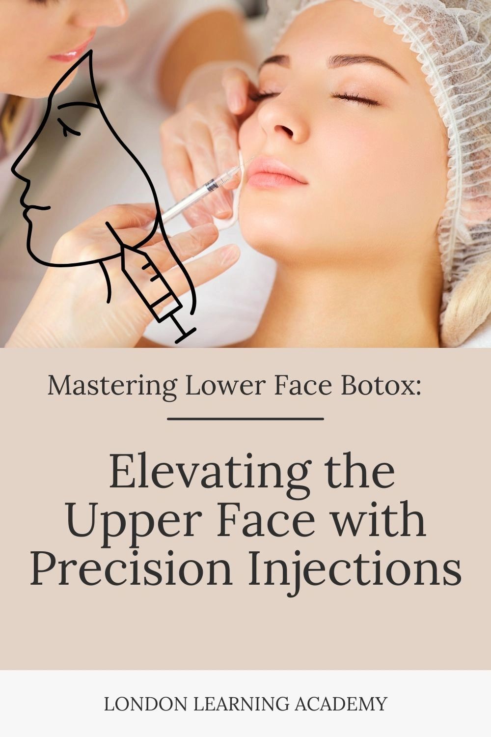 Mastering Lower Face Botox: Elevating the Upper Face