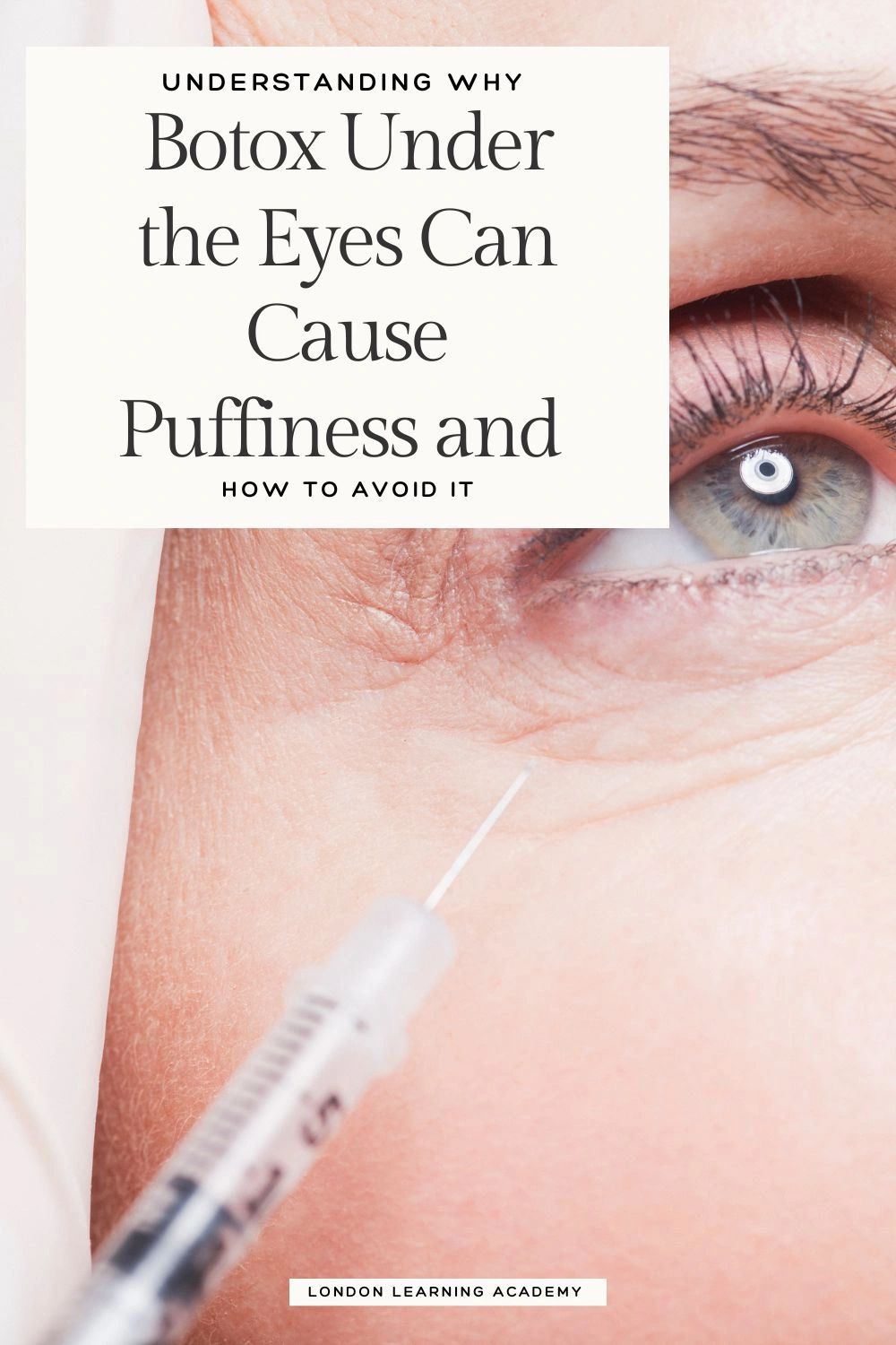 Understanding Why Botox Under the Eyes Can Cause Puffiness?