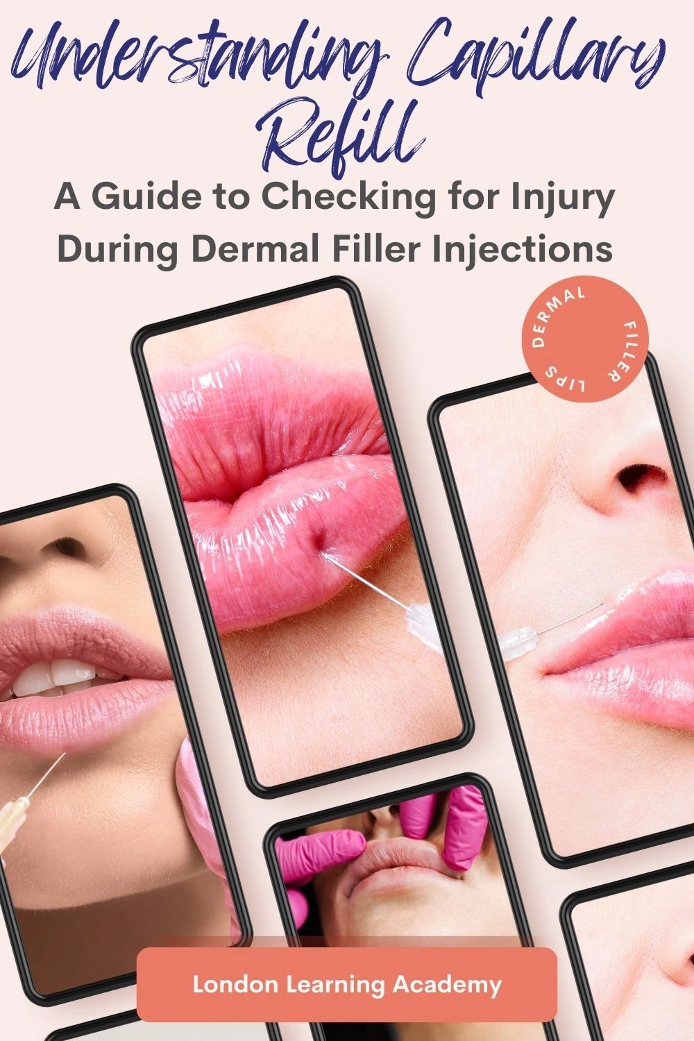 Understanding Capillary Refill: Checking for Dermal Filler Injury