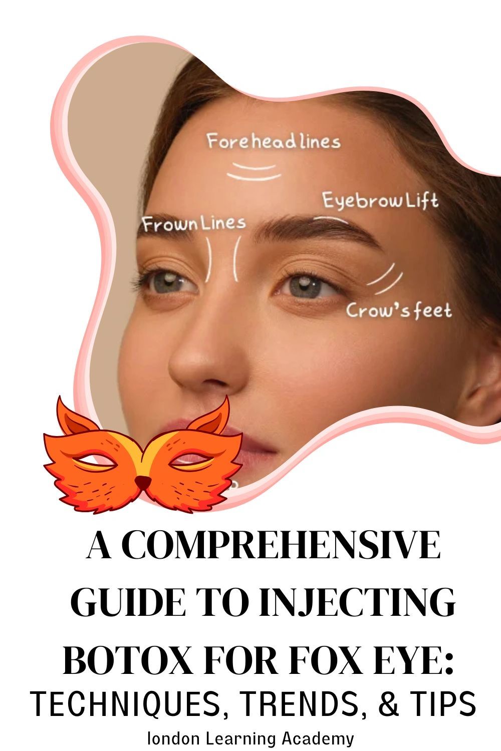 Injecting Botox for Fox Eye: Techniques, Trends, & Tips