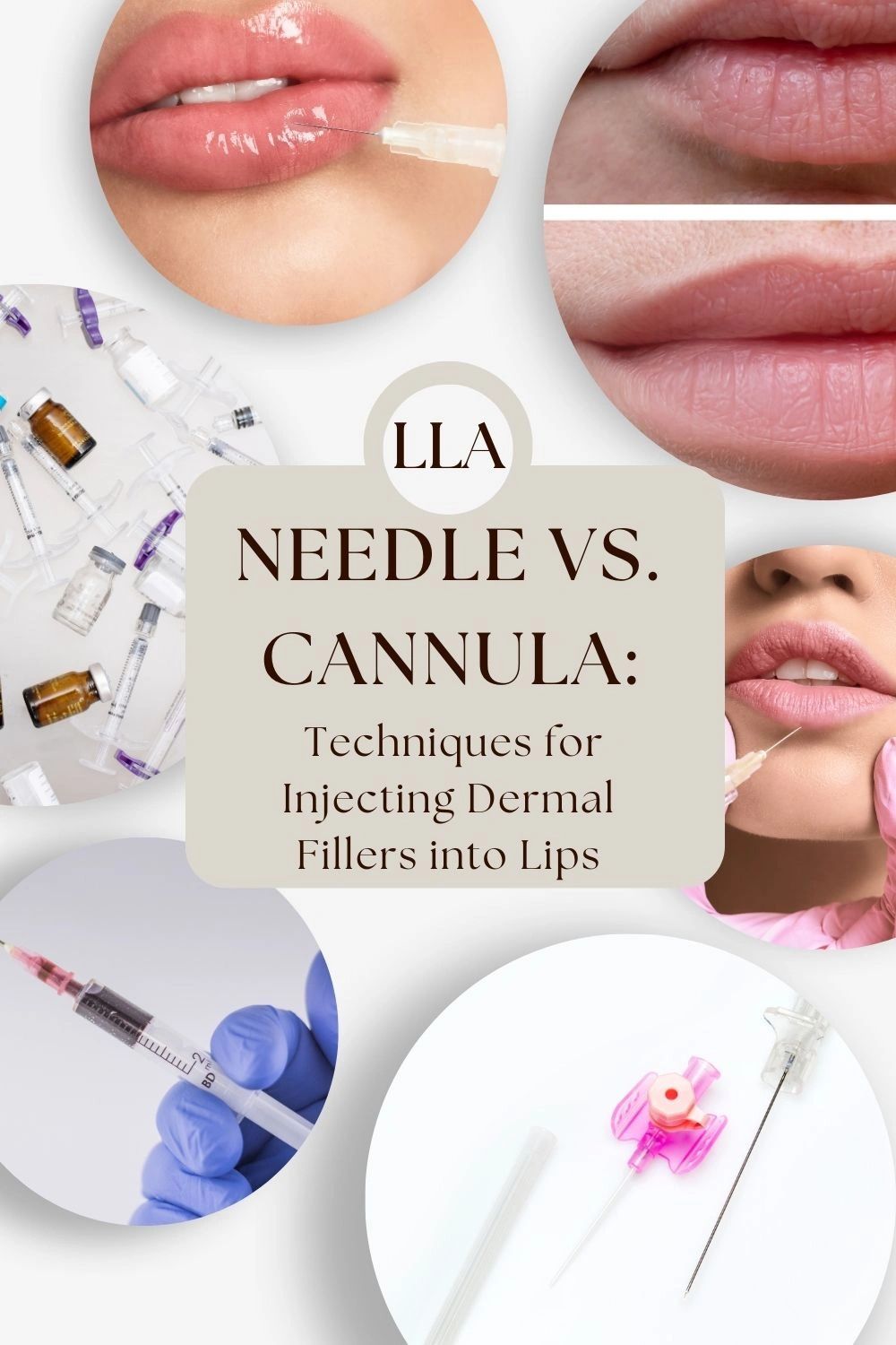 Needle vs. Cannula: Techniques for Injecting Dermal Fillers