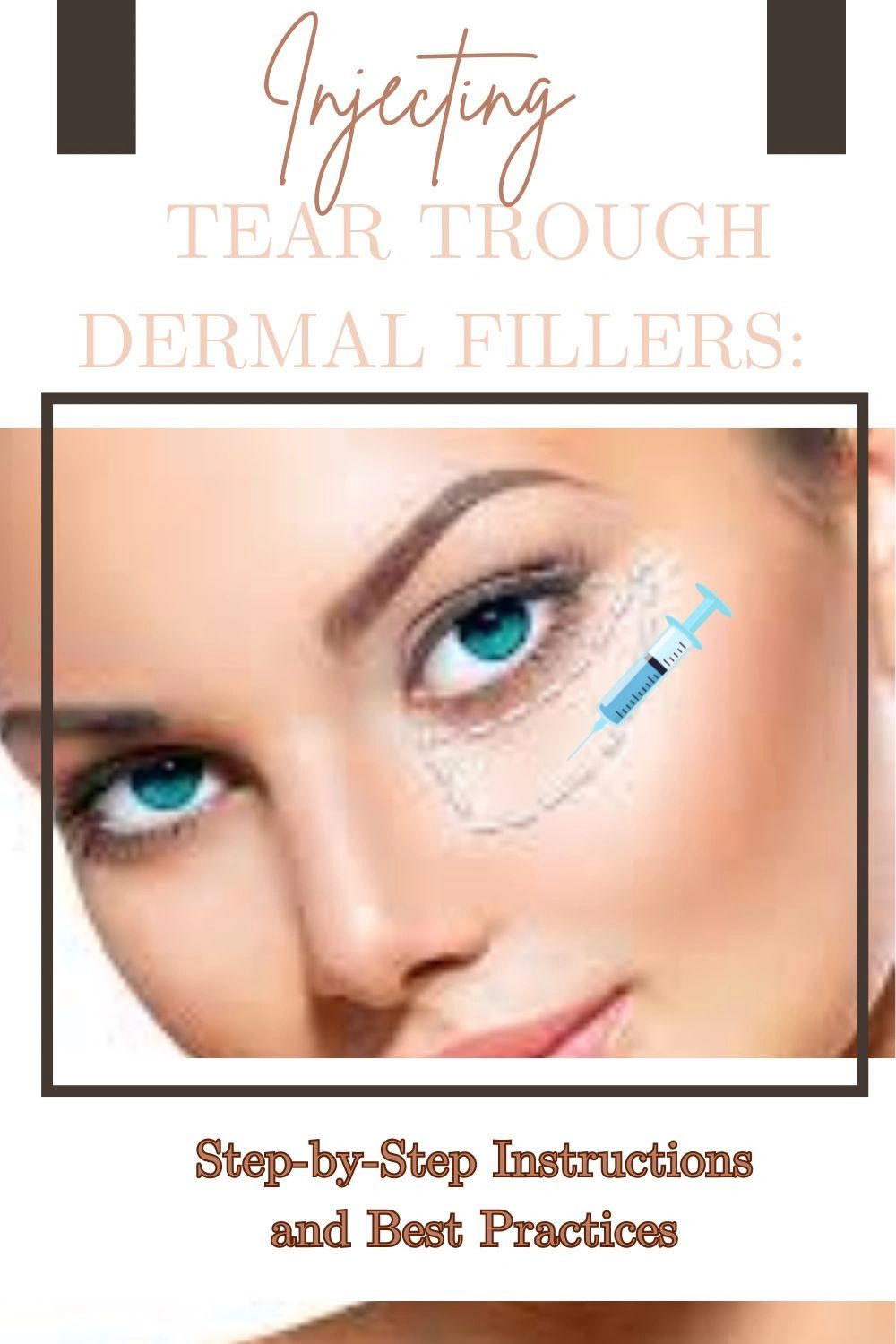 Injecting Tear Trough Dermal Fillers: Step-by-Step Instructions