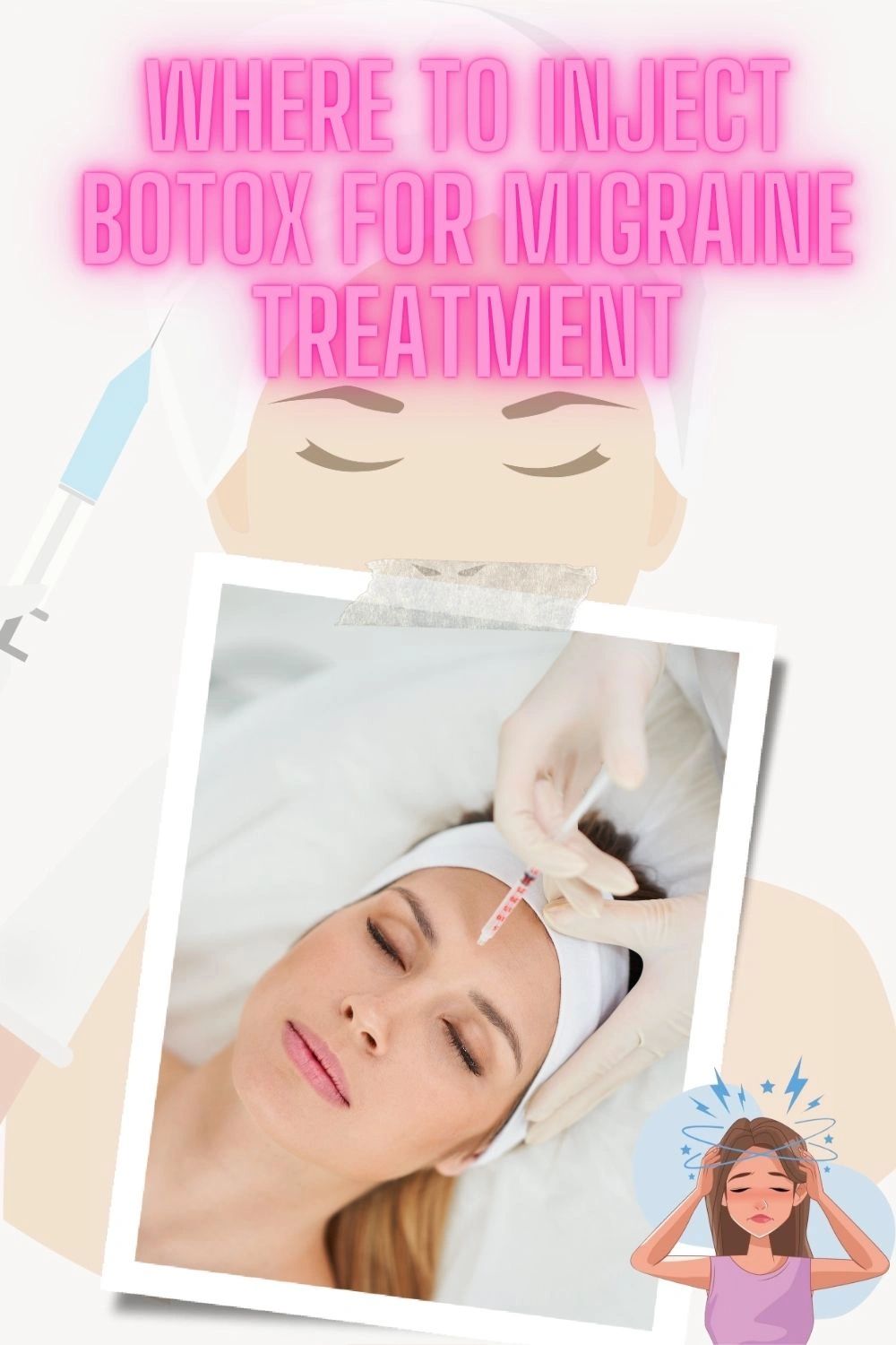 Where to Inject Botox for Migraine Treatment