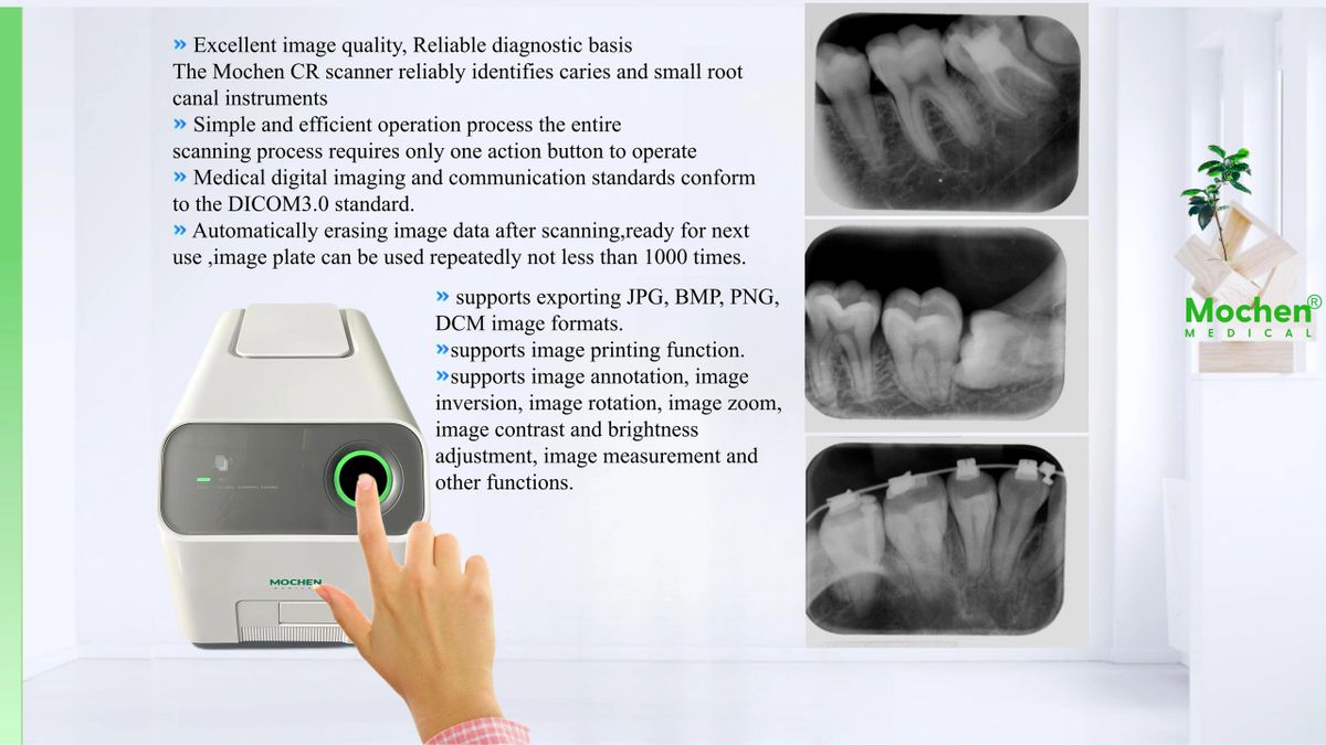 software for scanner IPS1 IPS2 IPS3 MC1 PSP Scanner manage dental X ray ...
