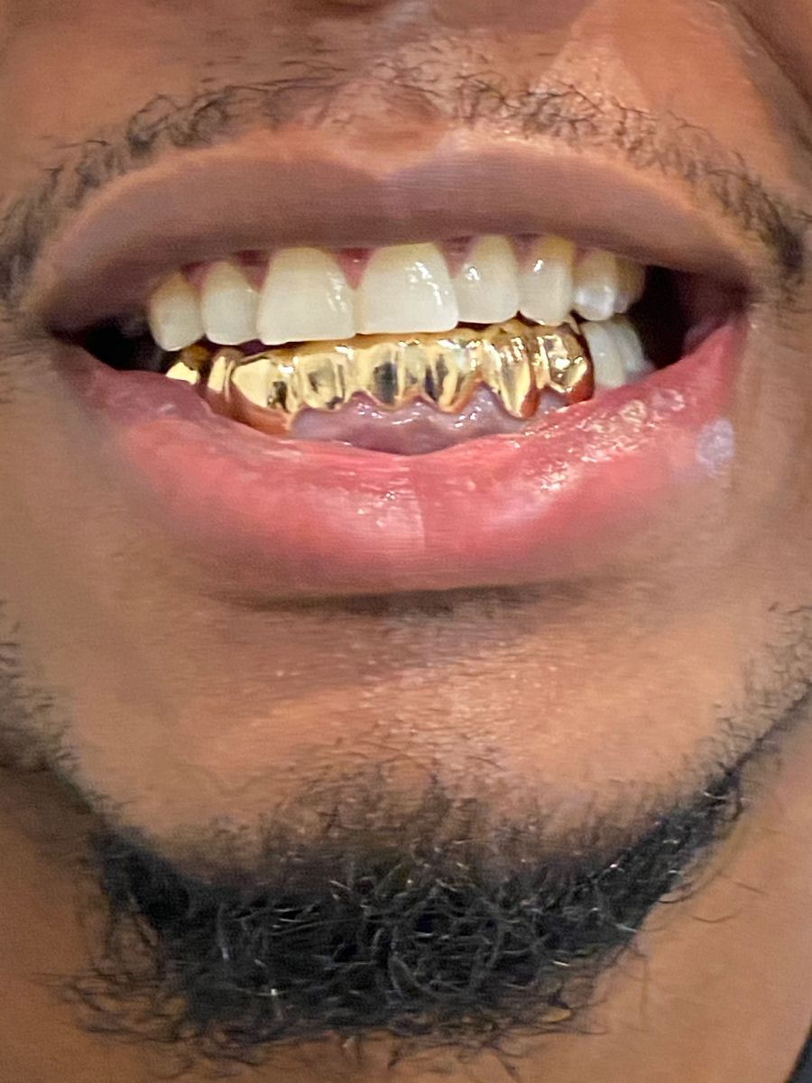 8 14kt Gold Tooth