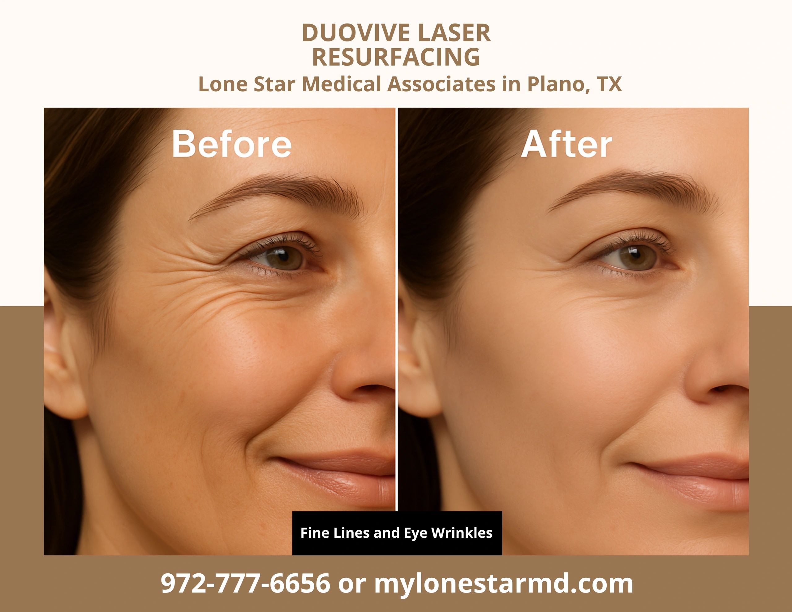 Smooth Fine Lines and Refresh the Eye Area With DUOVIVE Laser
